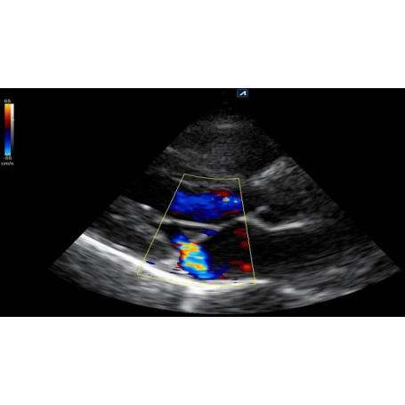 Ultrasound Alpinion Ecube9