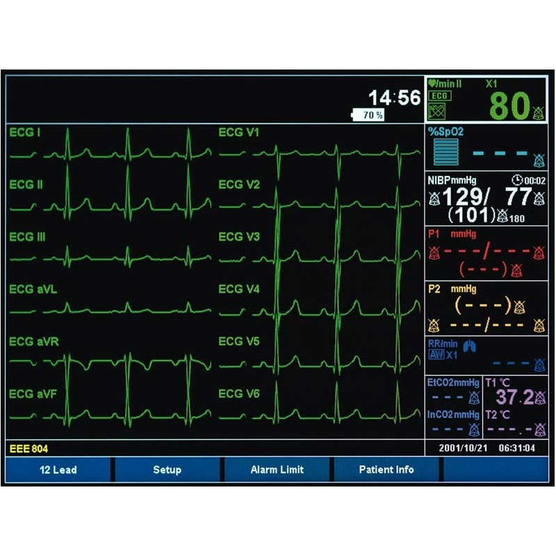DefiMonitor EVO Defibrillator | Medi-Shop.gr