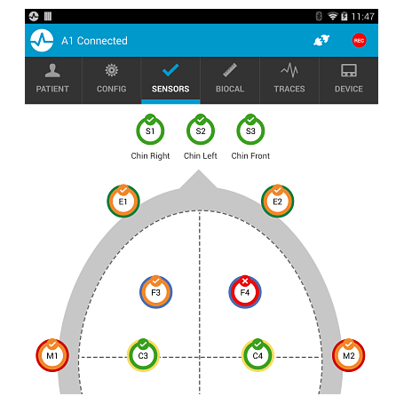 Nox A1 sleep diagnostic system | Medi-Shop.gr