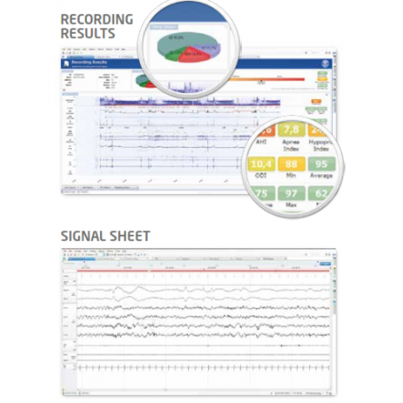Nox A1 sleep diagnostic system | Medi-Shop.gr
