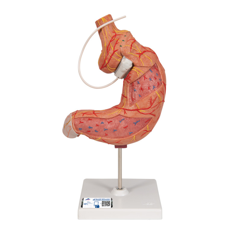3B Scientific 2-part stomach model with gastric band | Medi-Shop.gr