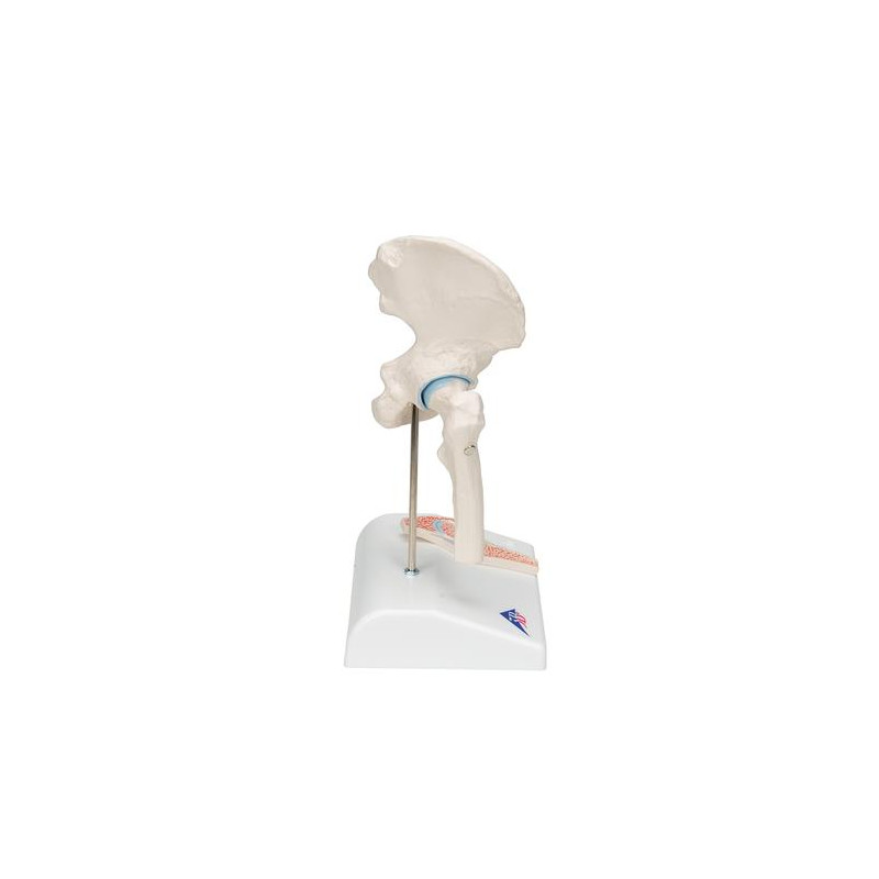 3B scientific mini hip joint model with cross section | Medi-Shop.gr