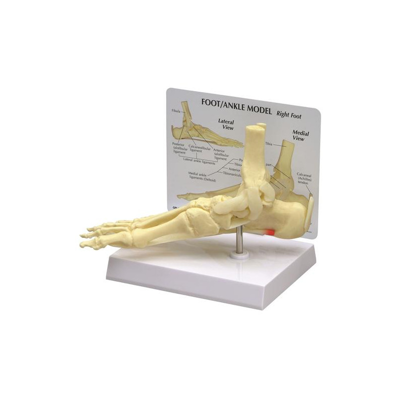 GPI Anatomicals foot plantar fasciitis model | Medi-Shop.gr