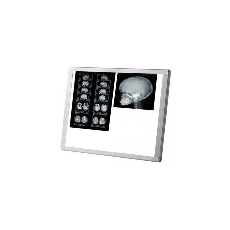 Mimsal AF 200 d/c LED X-Ray Viewer negatoscope | Medi-Shop.gr