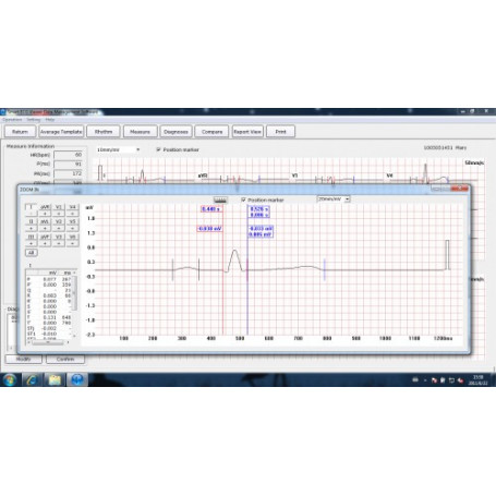 Smart ECG Viewer PC Software | Medi-Shop.gr