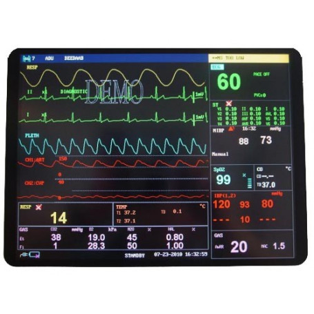 EDAN iM8A 10.4' Portable Patient Monitor | Medi-Shop.gr